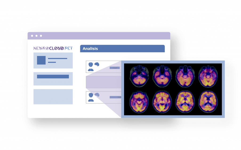 Qubiotech | Neurocloud PET