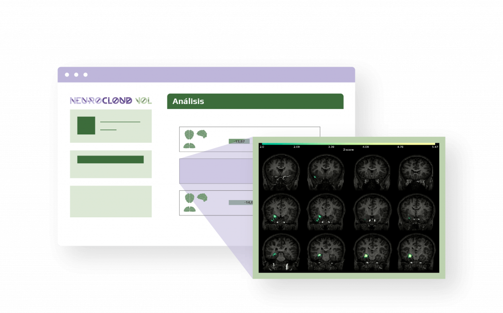 Qubiotech | Neurocloud VOL
