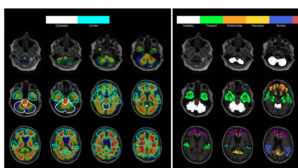 Qubiotech | Neurocloud PET