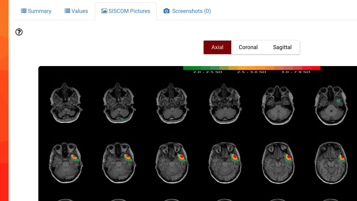 Qubiotech | Neurocloud SISCOM