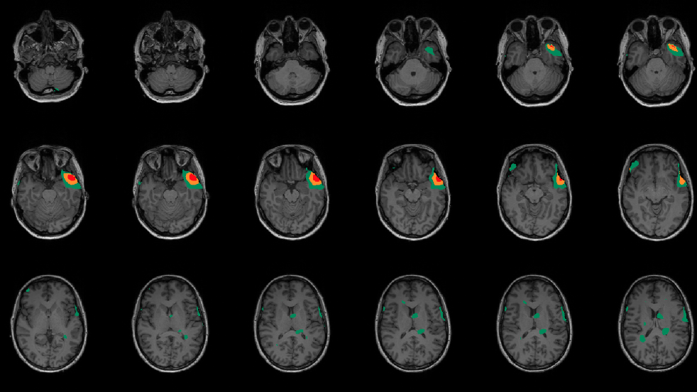 Qubiotech | Neurocloud SISCOM